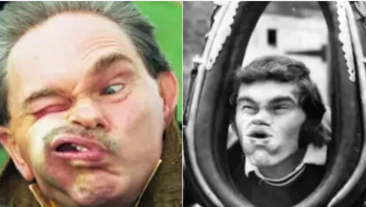 Gordon Mattinson: Father of World Gurning Championship Guinness World ...